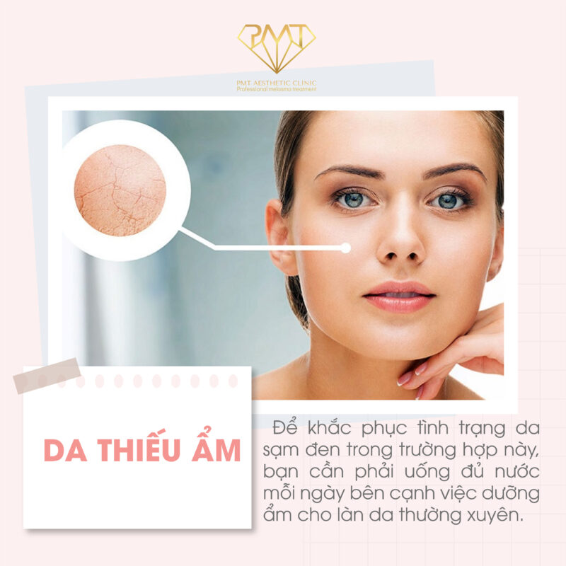 Những nguyên nhân khiến da sạm đen - PMT Aesthetic Clinic